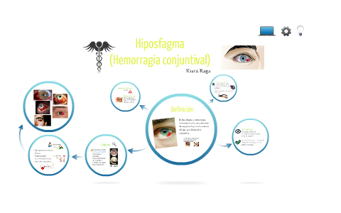 Hiposfagma by Kiara Raga on Prezi