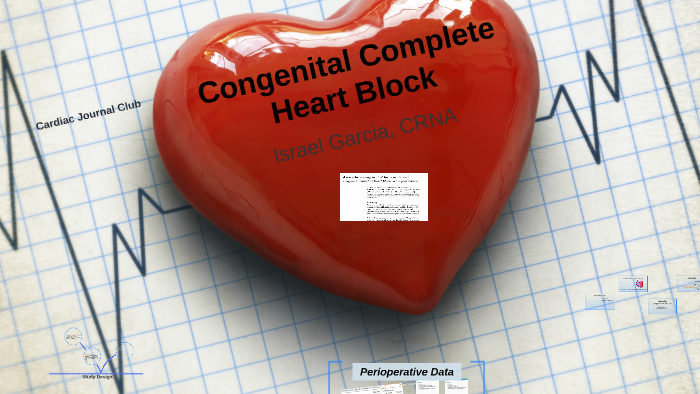 Congenital Complete Heart Block by Israel García on Prezi