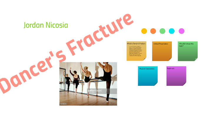 Dancer's Fracture by jordan nicosia on Prezi