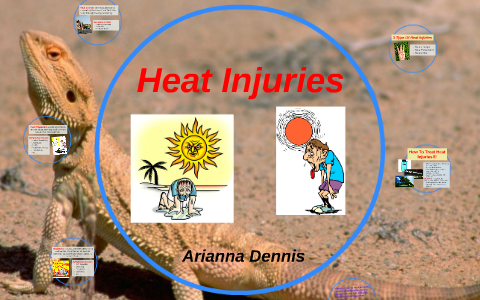 Heat Injuries by Arianna D on Prezi