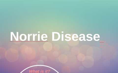 Norrie Disease by Kira J. on Prezi