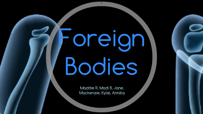 Foreign Body Presentation 2019 by Madison Roth on Prezi