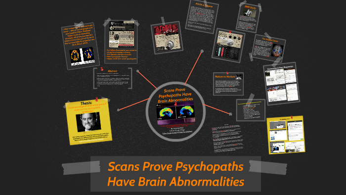 Brain Scans Prove Psychopaths Have Brain Abnormalities by Amanda Sitar ...
