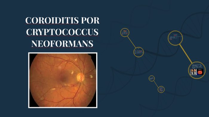 COROIDITIS POR CRYPTOCOCCUS NEOFORMANS by Andrea Duque on Prezi