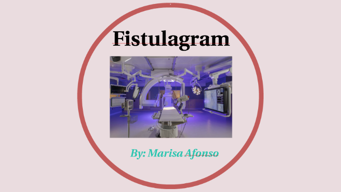 Fistulagram by Marisa Afonso on Prezi