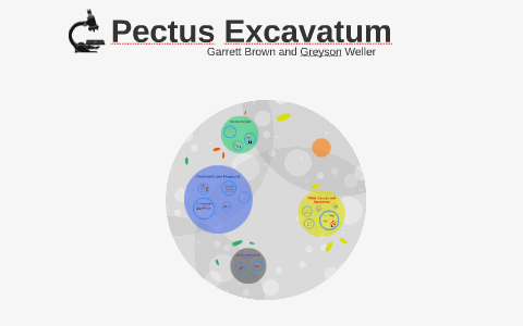 Pectus Excavatum by Garrett Brown on Prezi