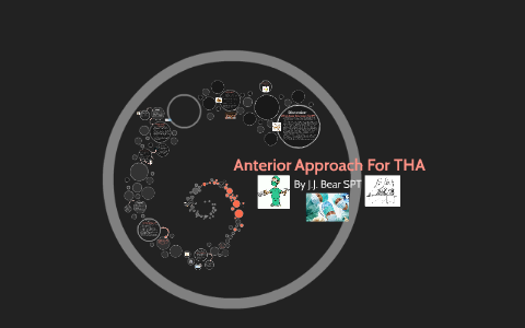 Anterior Approach Vs. Posterior Approach in THA by JJ Bear on Prezi