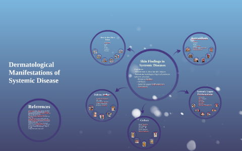 Dermatological Manifestations of Systemic Disease by Emily McKenzie on ...