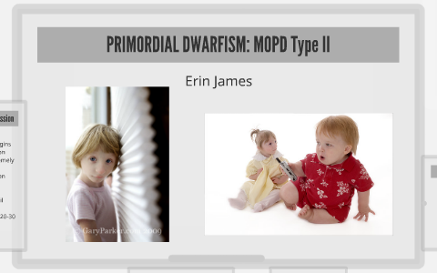 PRIMORDIAL DWARFISM by Erin James on Prezi