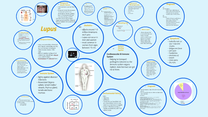 Lupus Presentation by Katelyn Cormier on Prezi