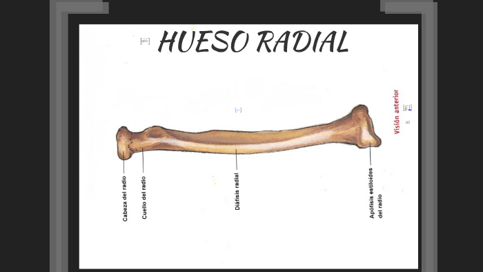 HUESO RADIAL by Irving Bailon Maldonado on Prezi
