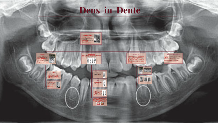 Dens in Dente by Gabriela Máximo on Prezi
