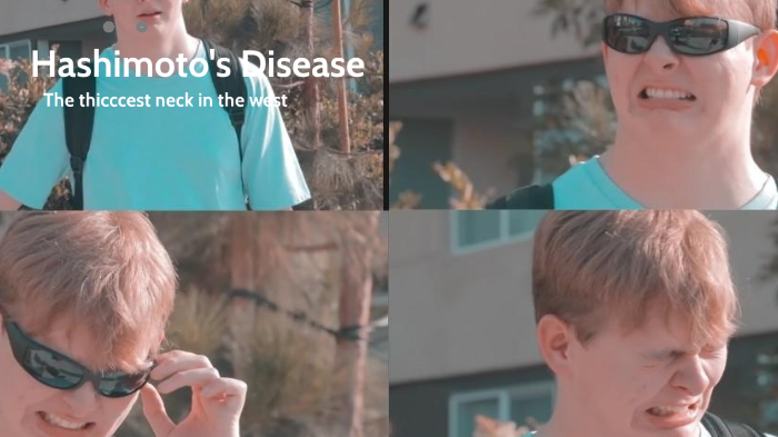 Hashimoto's Disease by Josh Davis on Prezi