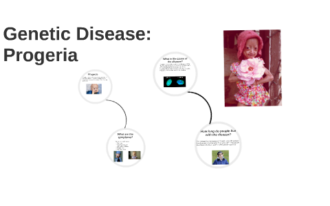 Genetic Disease: Progeria by Jordyn Ceasar on Prezi