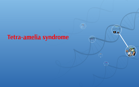 Tetra-amelia syndrome by Victoria McGhin on Prezi