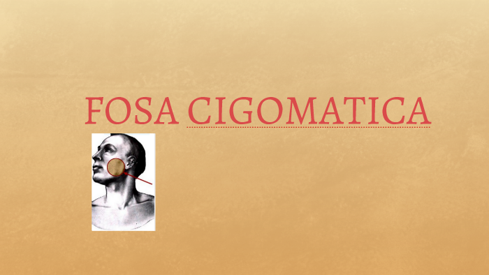 FOSA CIGOMATICA by Qarla Mishell L on Prezi