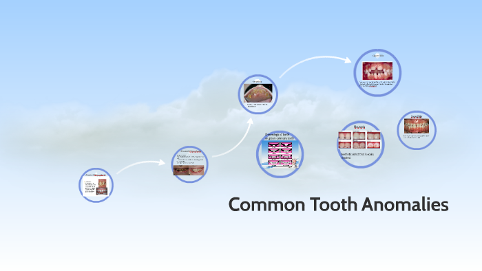 Common Tooth Anomalies by Xiomara Gonzalez on Prezi