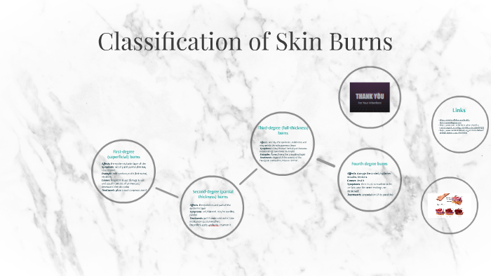 Classification of Skin Burns by Sztasák Anna on Prezi