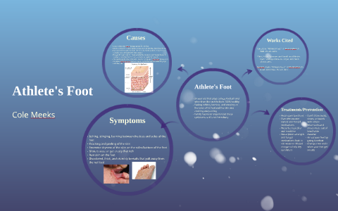 Athlete's Foot by Cole Meeks on Prezi