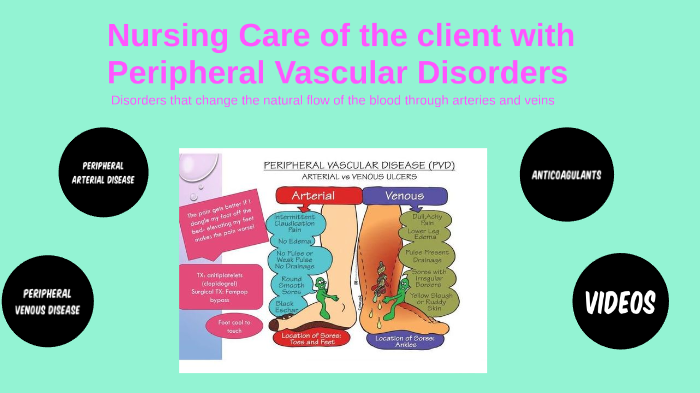Med Surg Nursing 2: PVD Presentation by Charity Furcsik on Prezi