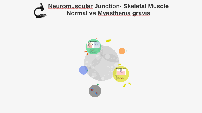 NMJ: Normal vs Myasthenia gravis by Kim Macleod on Prezi