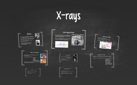 X-rays by on Prezi