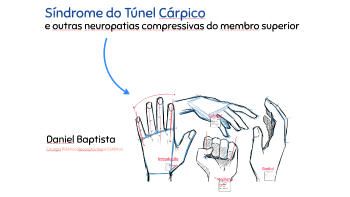 Síndrome do Túnel Cárpico by Daniel Baptista on Prezi