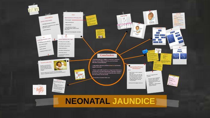 NEONATAL JAUNDICE by Syakirin B on Prezi