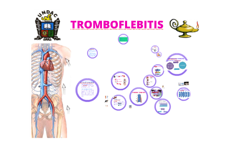 TROMBO FLEBITIS by on Prezi
