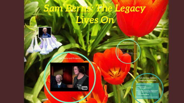 Progeria: The Story of Sam Berns by Kalionna Mathews on Prezi