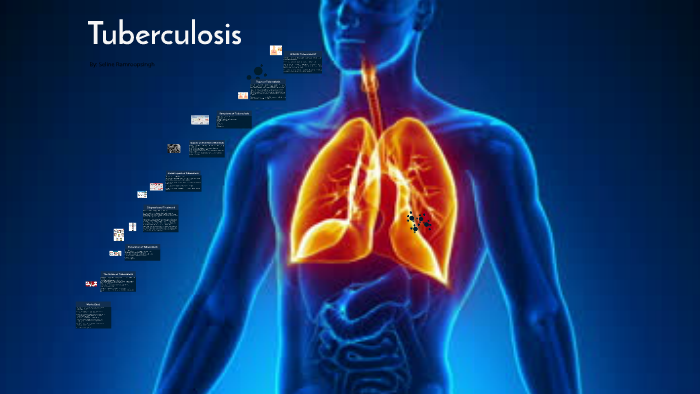 Tuberculosis PSA by Seline Ramroopsingh on Prezi