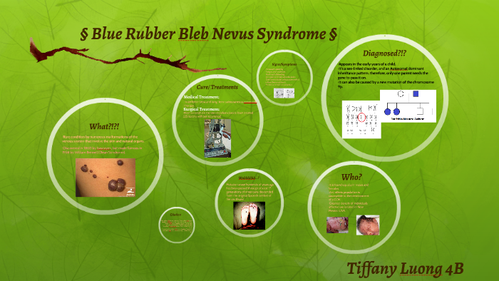 § Blue Rubber Bleb Nevus Syndrome § by Hi Hello on Prezi