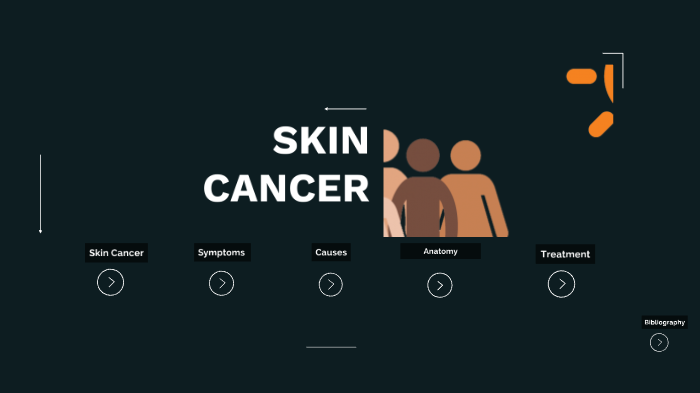 Skin Cancer Presentation by William Maxwell on Prezi