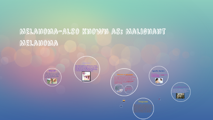 Melanoma-Also known as: Malignant Melanoma by Feda Odeh
