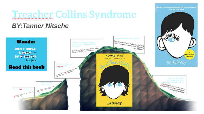 Treacher Collins Syndrome by Mrs. Henry