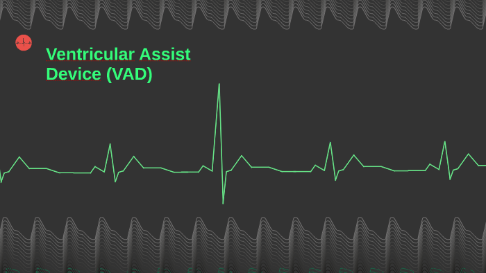 Ventricular Assist Device (VAD) by Terrin Ivy on Prezi
