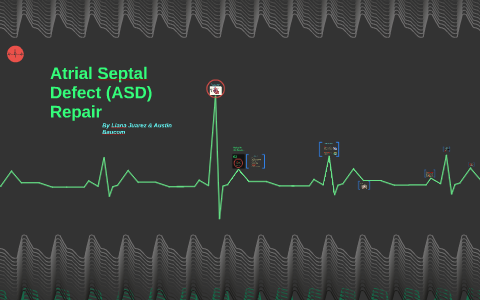 Atrial Septal Defect (ASD) Repair by Liana Juarez on Prezi