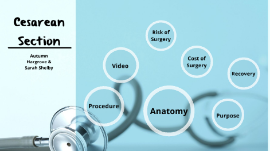 Cesarean section powerpoint templates | Prezi
