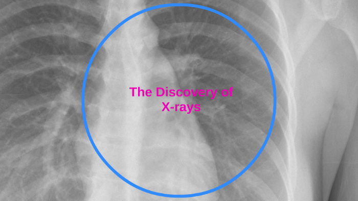 The Discovery of X-rays by Landy Townsend-Gayle on Prezi