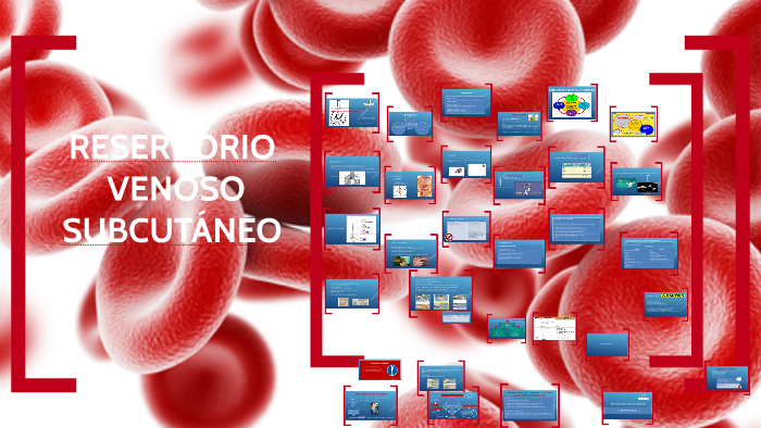 MANEJO INTRAHOSPITALARIO DEL RESERVORIO VENOSO SUBCUTÁNEO EN ESPAÑA by ...