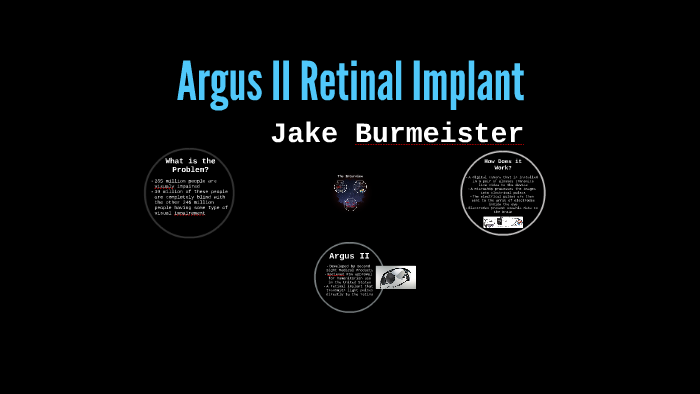 Argus II Retinal Implant by on Prezi