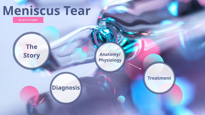 Meniscus Tear (Jenna&Tay) by alaria neufeld on Prezi