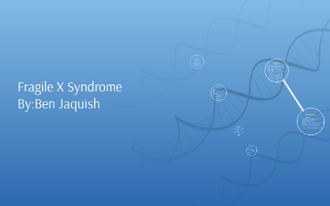 Fragile X Syndrome by Ben Jaquish on Prezi