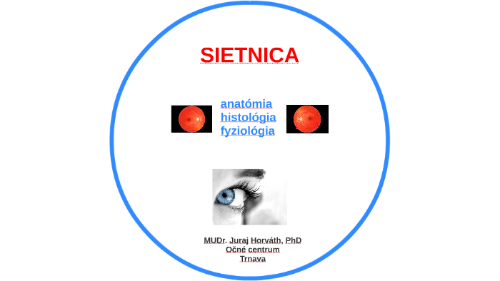 SIETNICA by Juraj Horváth on Prezi