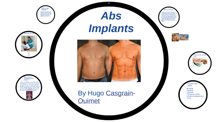 Abdominal Augmentation (6 pack implants) by Hugo Casgrain-OUimet on Prezi