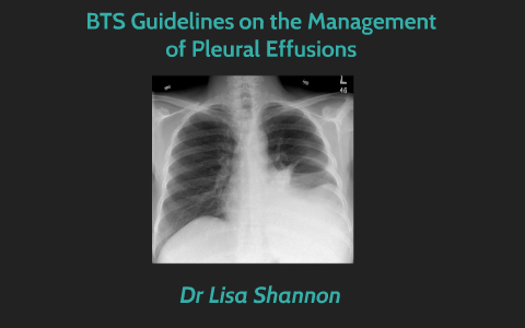 BTS Guidelines on Management of Pleural Effusions by Lisa Shannon on Prezi