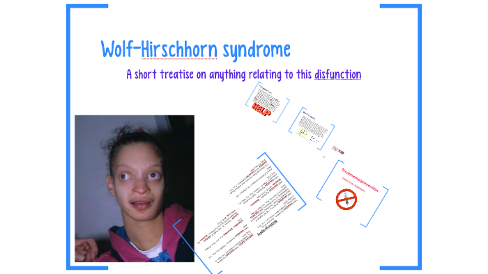 Wolf-Hirschhorn syndrome by Michael Castillo on Prezi