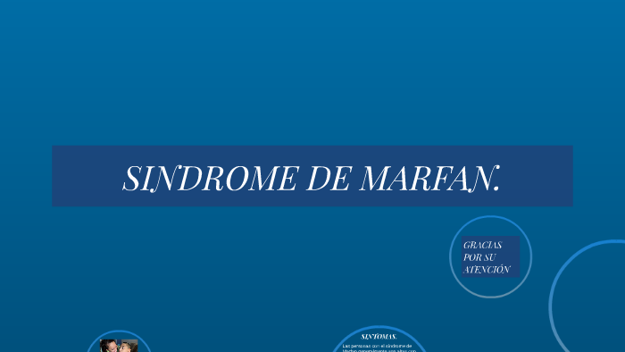 SINDROME DE MARFAM. by DIANA CALDERON on Prezi