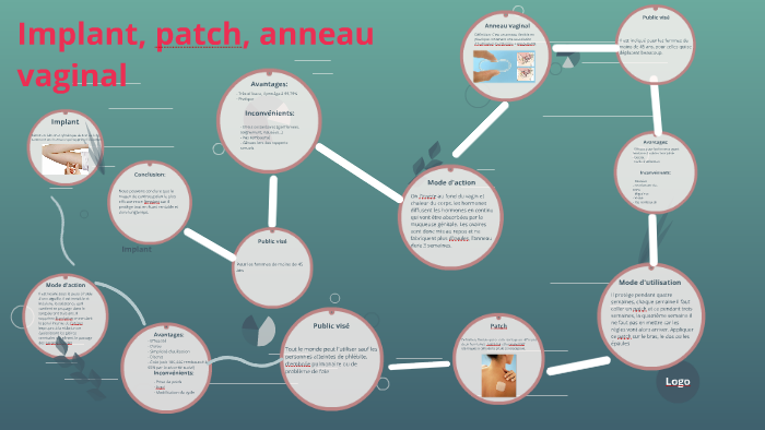 Implant, patch, anneau vaginal by Sarah VILLEGAS on Prezi