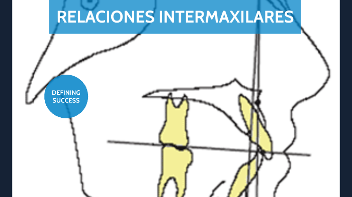 RELACION INTERMAXILAR by christian perez on Prezi